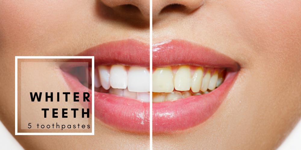5 Good Toothpastes that ACTUALLY Make Your Teeth Whiter
